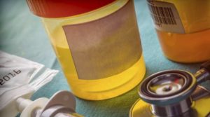 Tipos de exame toxicológico | Exame Toxicológico